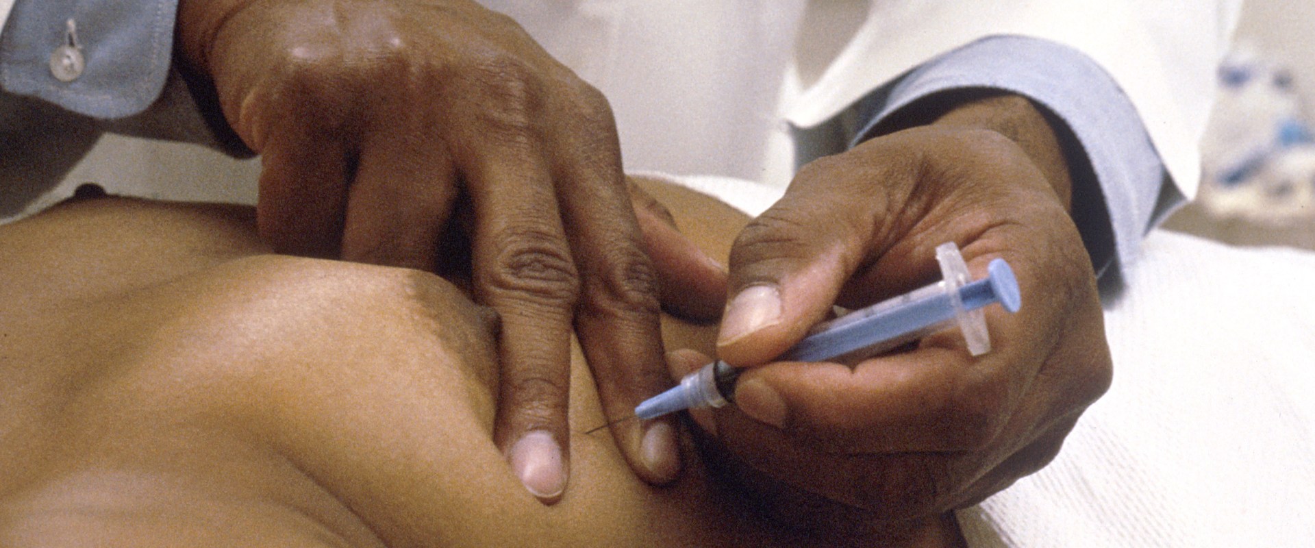 Risks of the Excisional Biopsy Technique